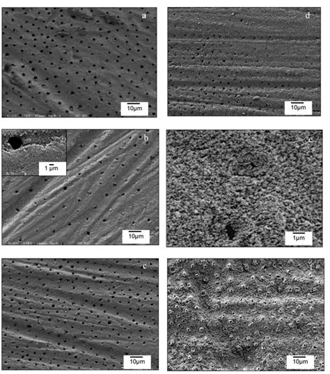 Sem Of Dentin Surfaces A Smear Layer Free Surface With Open Exposed Download Scientific