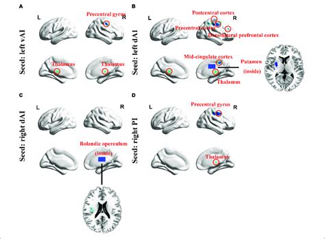 Whole Brain Voxel Wise Functional Connectivity Patterns Of The Insula