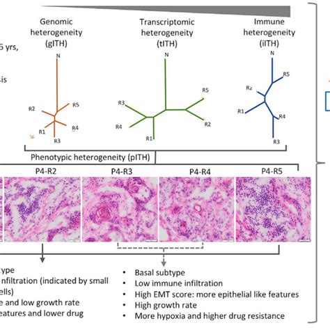 Assessment Of Intra Tumor Immune Heterogeneity In Lung Squamous Cell