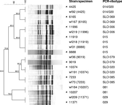 Comparison Of Pcr Ribotyping Profiles Obtained Directly From Stool Download Scientific Diagram