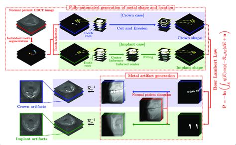 Overall Process Of Fully Automated Paired Training Data Generation Download Scientific Diagram