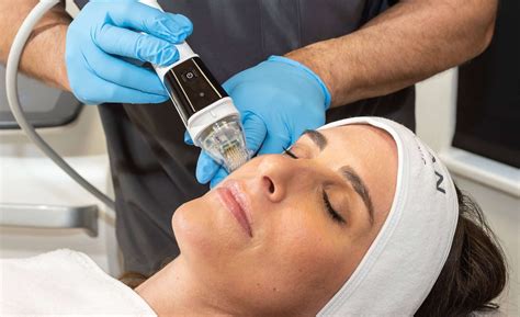 Microneedling Reading Milan Skin Clinic