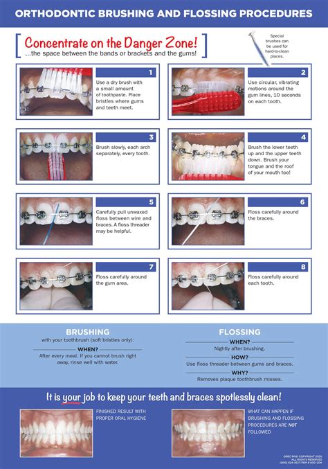 Item 600 204 Brushing And Flossing Poster Orec