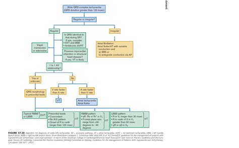 Cardiology Window ECG Broad Complex Tachycardia