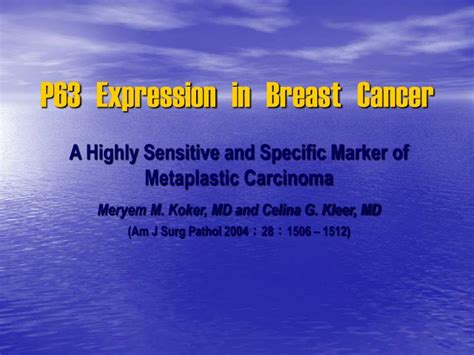 Ppt P63 Expression In Breast Cancer Powerpoint Presentation Free
