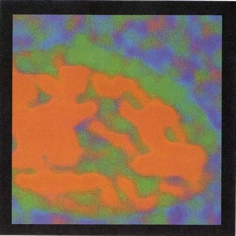 Result Of A Generalized Multi Resolution Analysis With A Subimage Size