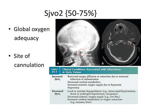 Care Of The Patient Following Craniotomy Pptx
