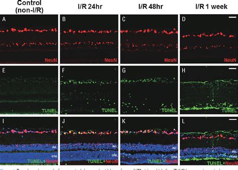 Figure 4 From Retinal Ischemia Reperfusion Rat Model With Double