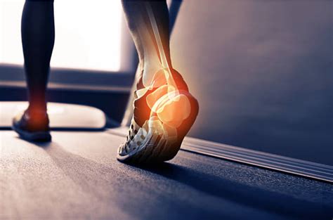 Gait Analysis Can It Help You Central Therapy