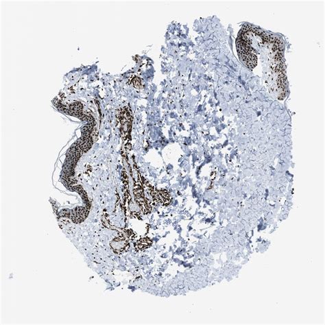 Tissue Expression Of Hnrnpu Staining In Skin The Human Protein Atlas
