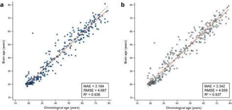 Science Monitor On Linkedin Brain Age Prediction Using Combined Deep Convolutional Neural