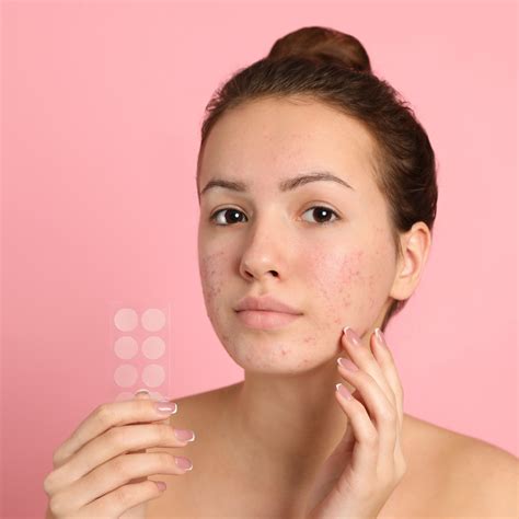 ﻿대학로 피부과 여름철 레이저로 점빼기 후 잘 관리하셔야 자국이 남지 않습니다 성신여대 포이즌 피부칼럼 성신여대피부과 포이즌의원