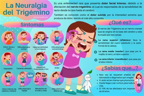 Infografía De La Neuralgia Del Trigémino Somosdisc