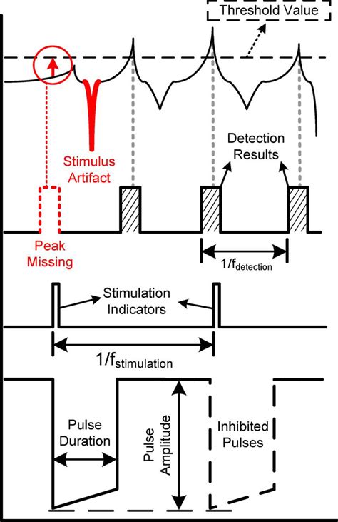 Operation Of The Proposed Imsoc And The Stimulation Parameters Download Scientific Diagram