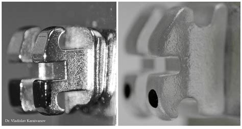 Vladental Orthodontics Какви брекети да изберем естетични или метални Дилемата дали да се