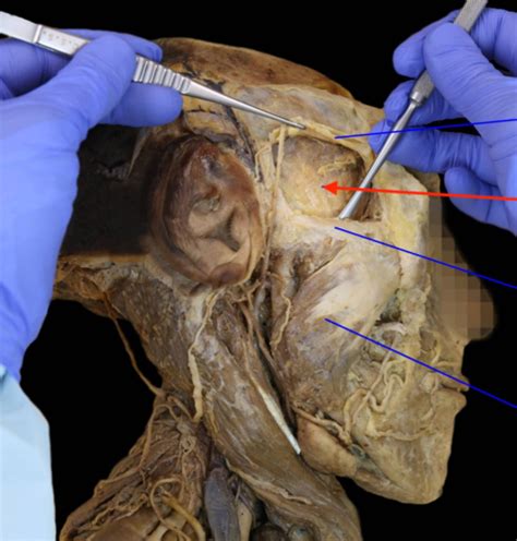 Lab 6 Infratemporal Fossa TMJ Nasal Cavity Flashcards Quizlet