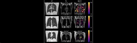 What Do Ct Chest 3d Reports Show Ganesh Diagnostic