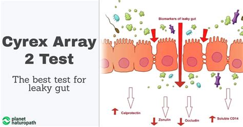 cyrex array 2 test the best test for leaky gut