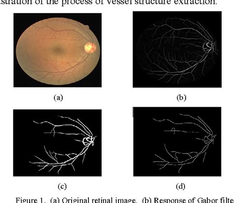 Figure 1 From Efficient And Robust Optic Disc Detection With Vessel