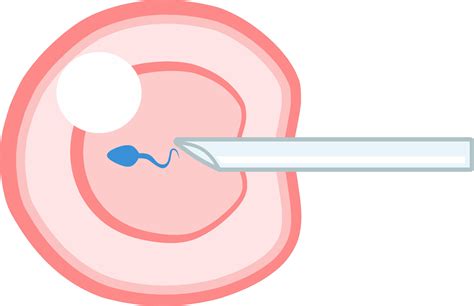 Ivf Icsi Vector Illustration Perfect For Presenting Anything About Reproduction Insemination