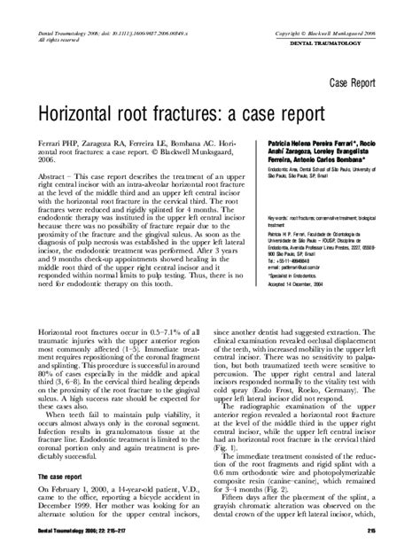 Pdf Horizontal Root Fractures A Case Report