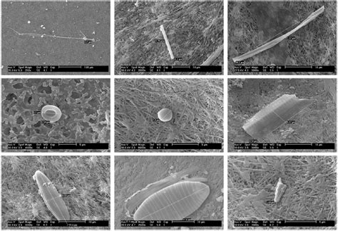 Microplastic Images Captured By SEM Download Scientific Diagram