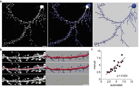 Automated Analysis Of Dendritic Spine Morphology Oxford Instruments