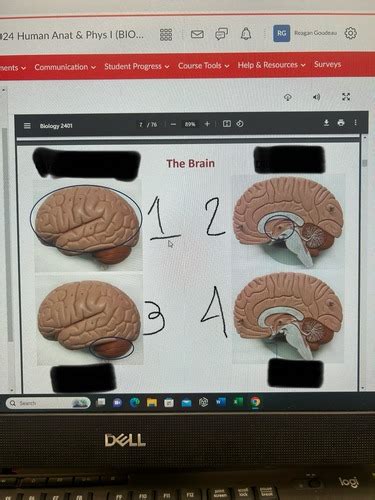 Lab Quiz Brain And Spinal Cord Flashcards Quizlet