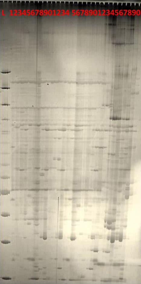 Sequence Related Amplified Polymorphism Srap Of Genomic Dna Extracted Download Scientific