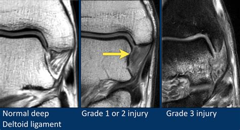 The Radiology Assistant Ankle Mri Examination