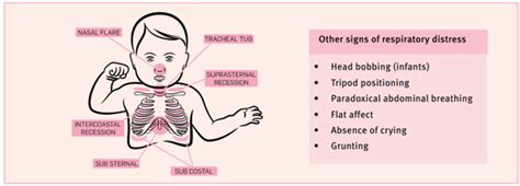 Rsv Bronchiolitis Rch