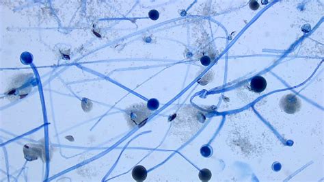 Mucor Under Microscope