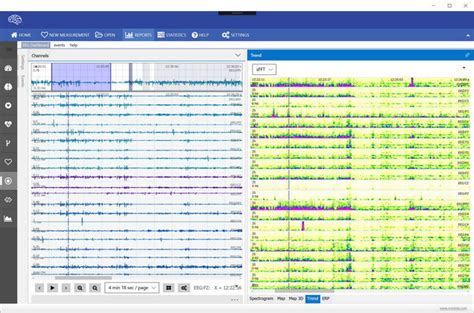 Brainview Eeg Pro Software Brainview