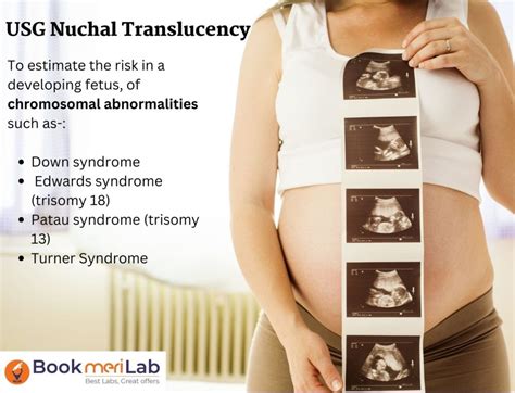 What Is Nt And Nb Scan At Emily Marsh Blog