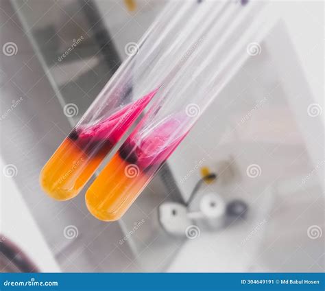 Salmonella Detection Method By Using Triple Sugar Iron Tsi Agar In Microbiology Laboratory