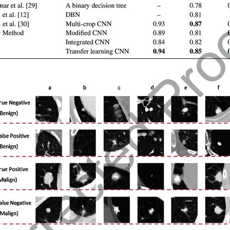 samples of pulmonary nodule classification results download