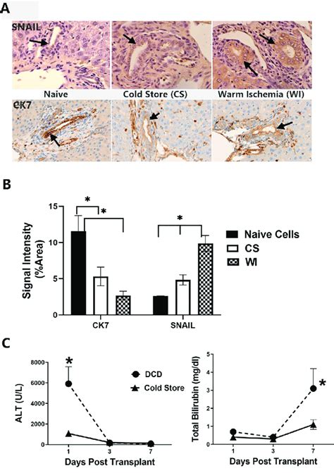 Rat Liver Ischemic Cholangiopathy Model Immunohistochemical Analysis