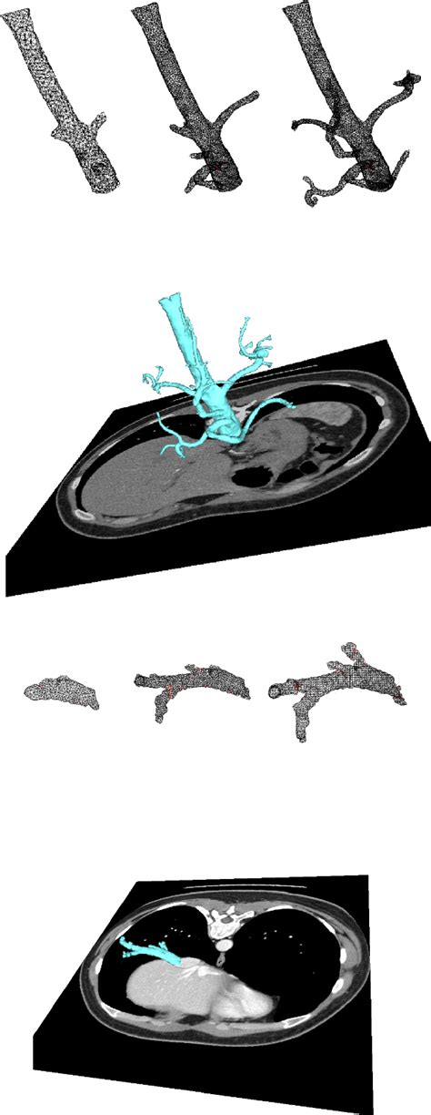 Figure 4 From Robust Segmentation Of Anatomical Structures With