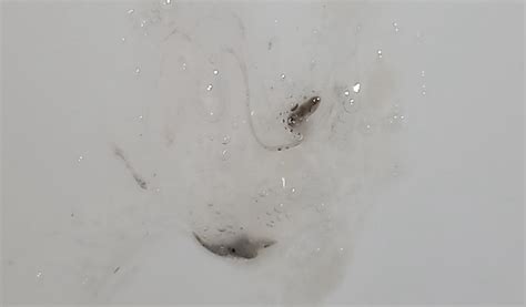 This Black Stuff Is In My Snot From My Sinuses Everyday Would That Be