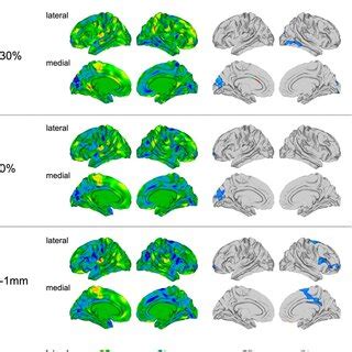 Groupbysex Interaction Effects For Fractional Anisotropy FA Download Scientific Diagram