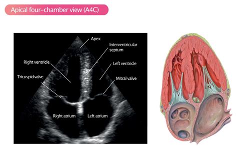 Standard Transthoracic Echocardiogram Complete Imaging Protocol Ecg And Echo