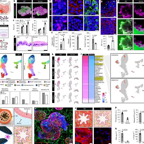 Organoid Based Model Of Human Ibd In Octopus A Adult Stem Cells