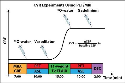 Table 1 From Using Arterial Spin Labeling To Measure Cerebrovascular Reactivity In Moyamoya