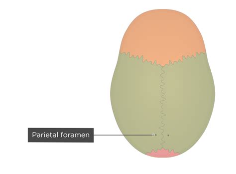 Parietal Foramen Skull