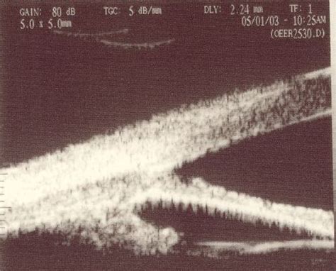 Ultrasound Image Processing