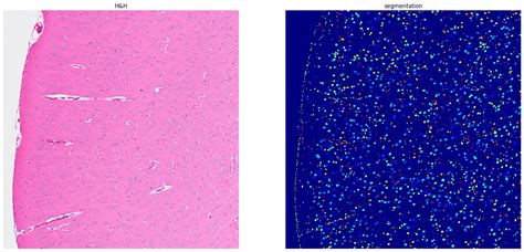 Nuclei Segmentation By Stardist Smurf