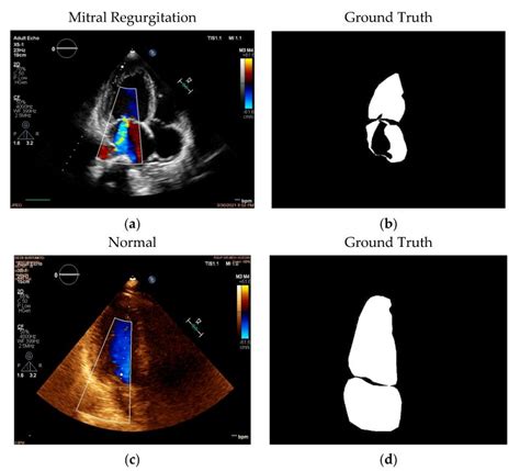Convolutionalneuralnetworks Cnn Deeplearning Imagesegmentation Image Data Big Data And