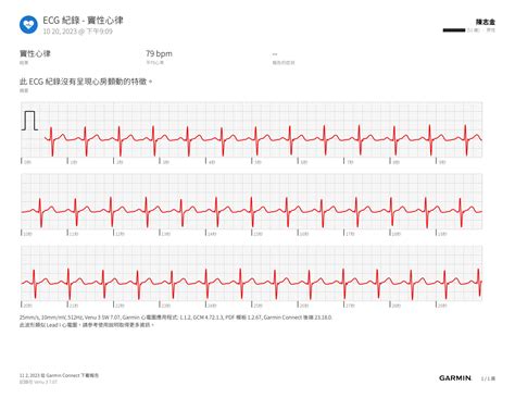 心血管疾病不只因肥胖 睡眠障礙造成多重影響專家智慧手錶日常紀錄幫助自我健康管理 Heho健康