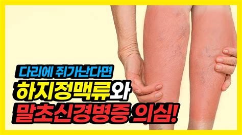 다리에 쥐가 계속 난다면 특히 주의해야 할 질환들 Youtube