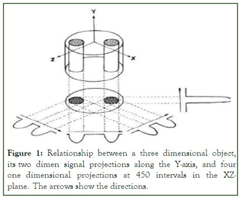 Gradient Magnetic Field Of Mr Scanners